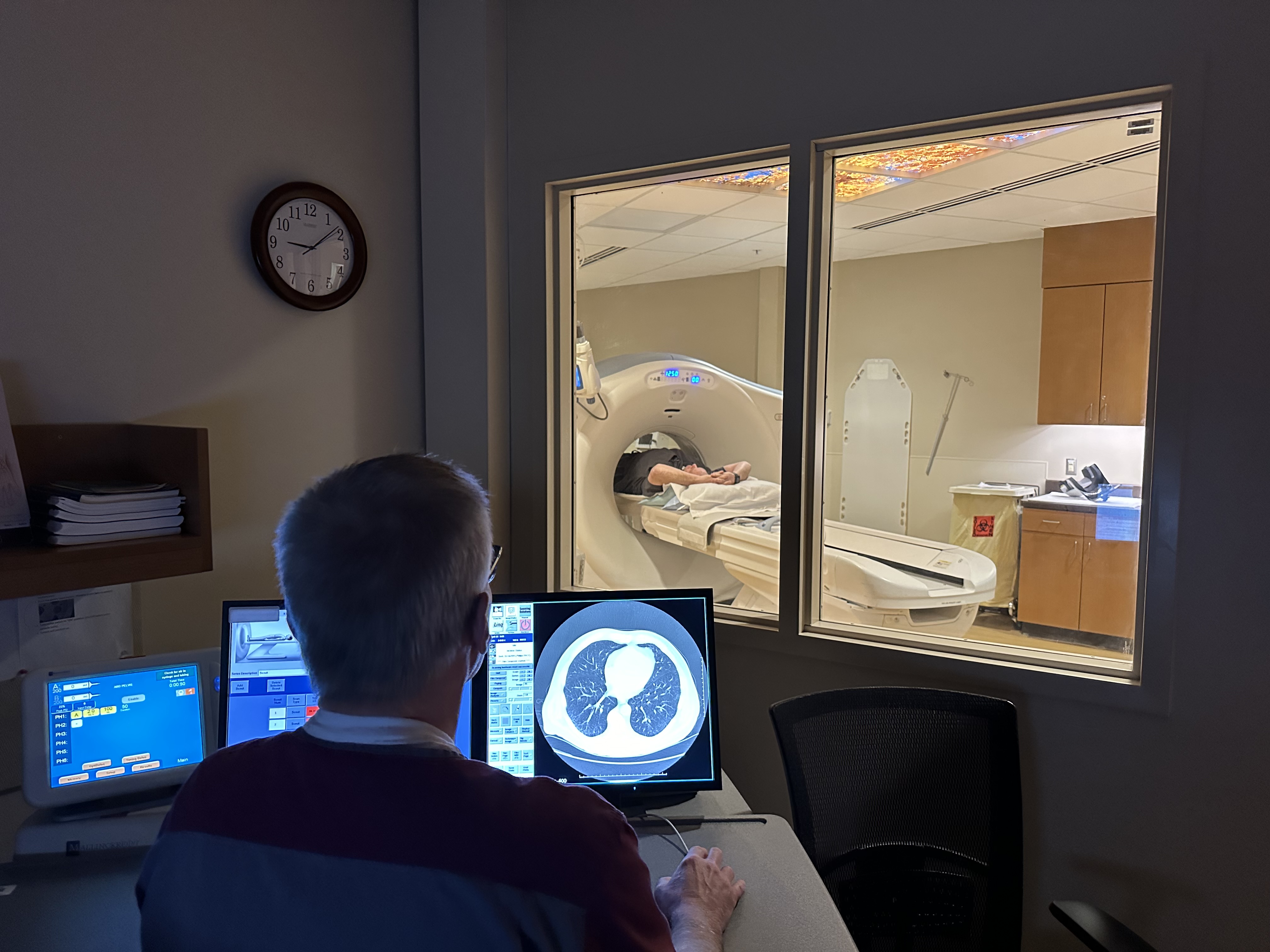 Aspirus Iron River Hospital now offering lung cancer screenings | Press ...